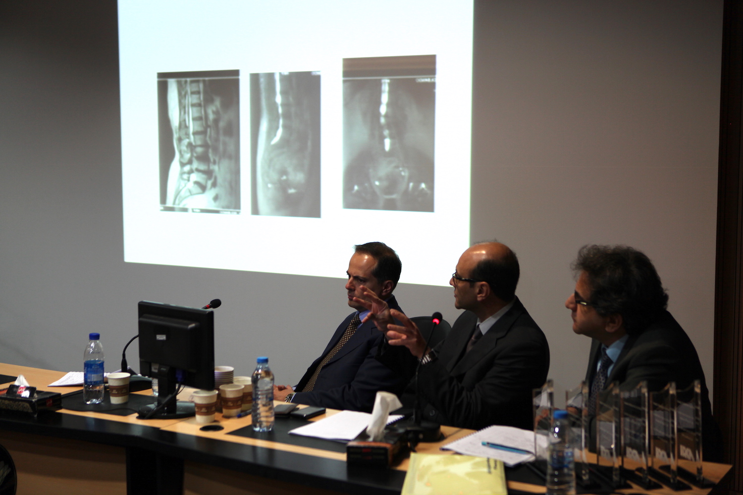 The 5th Multidisciplinary Irca Congress On Conservative Vs Surgical