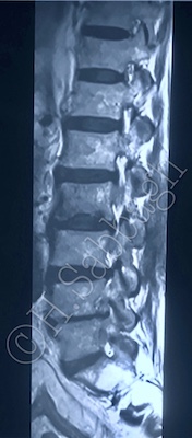 Advanced Diagnostic Imaging Study Presentation / Clinical Correlation ...